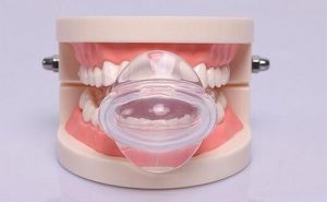 Tongue Retaining Device - the Ultimate Sleep Pacifier